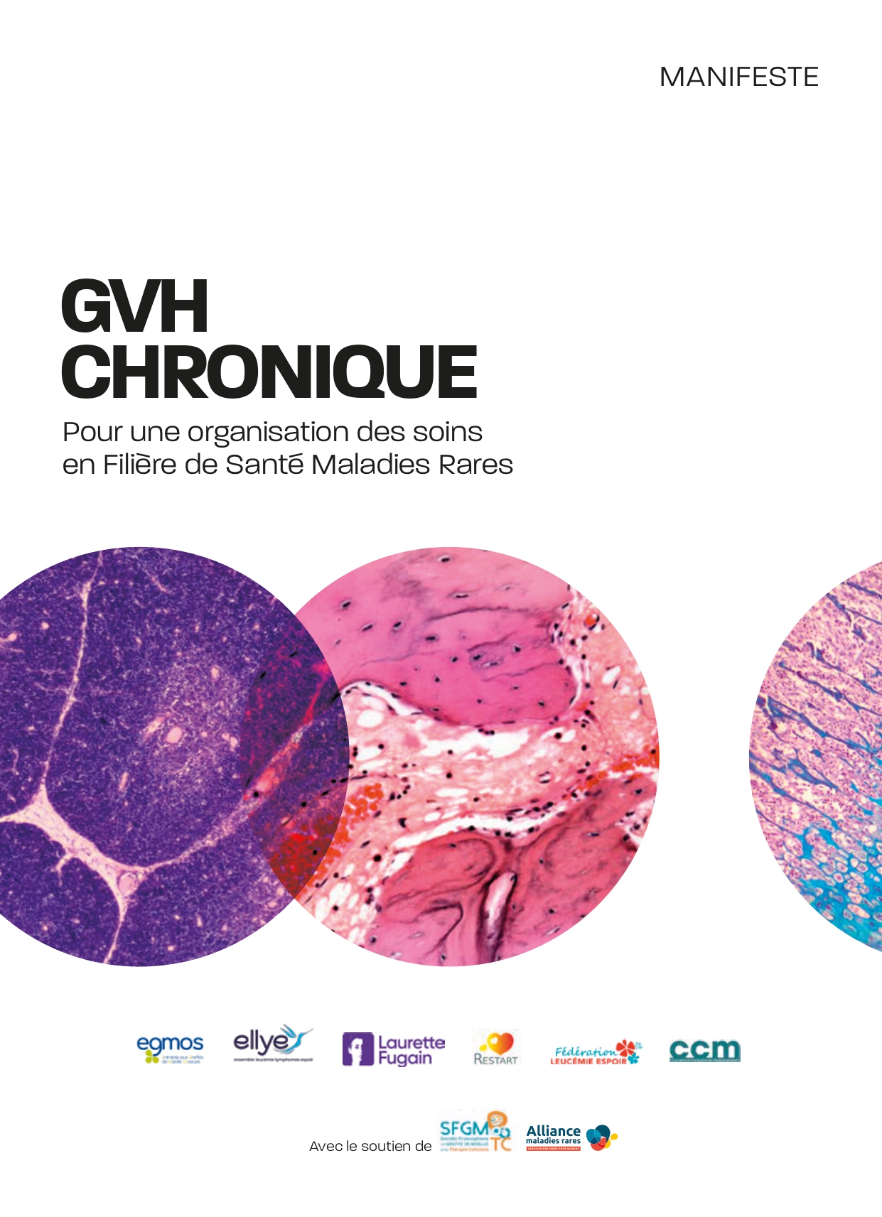 Manifeste « GvH chronique – Pour une organisation des soins en Filière ...